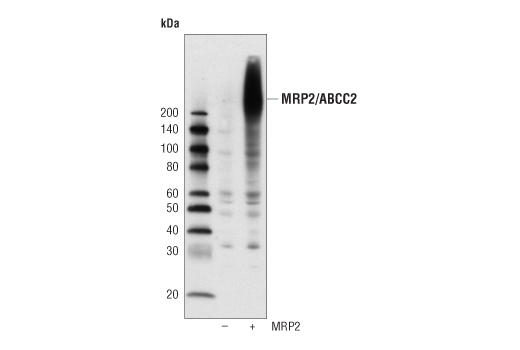 MRP2-ABCC2 -R260- Antibody_CST_优宁维(univ)商城