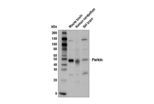 CST_Parkin Antibody_优宁维(univ)商城