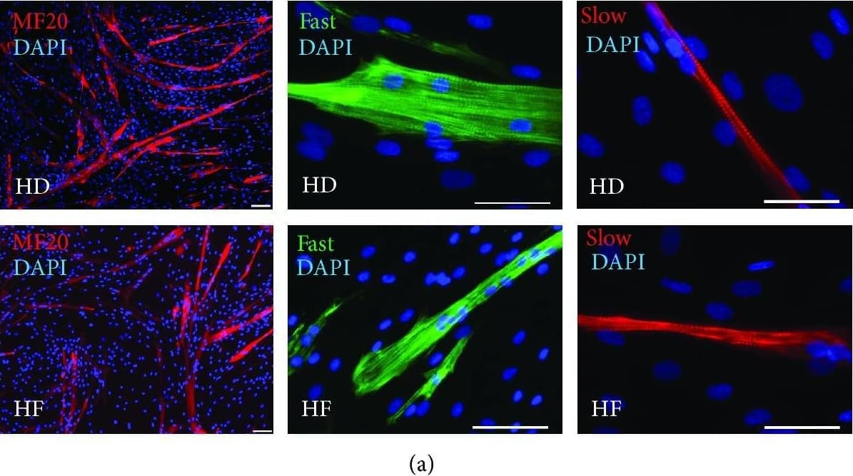 Myosin Heavy Chain MAb -Clone MF20- -25 ug_R&D Systems_优宁维(univ)商城