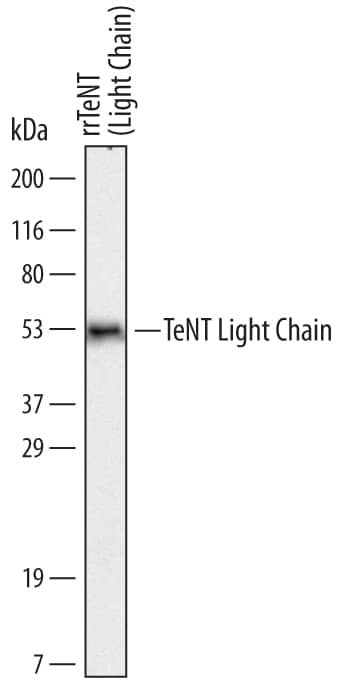 TeNT Light Chain MAb -25 ug_R&D Systems_优宁维(univ)商城